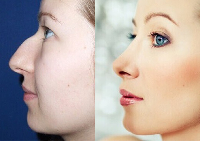 Plastična hirurgija - Ars Medica